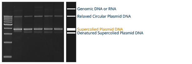 How to check the quality of plasmid DNA