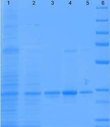 Phytip® columns vs other technologies: Comparative analysis of protein ...